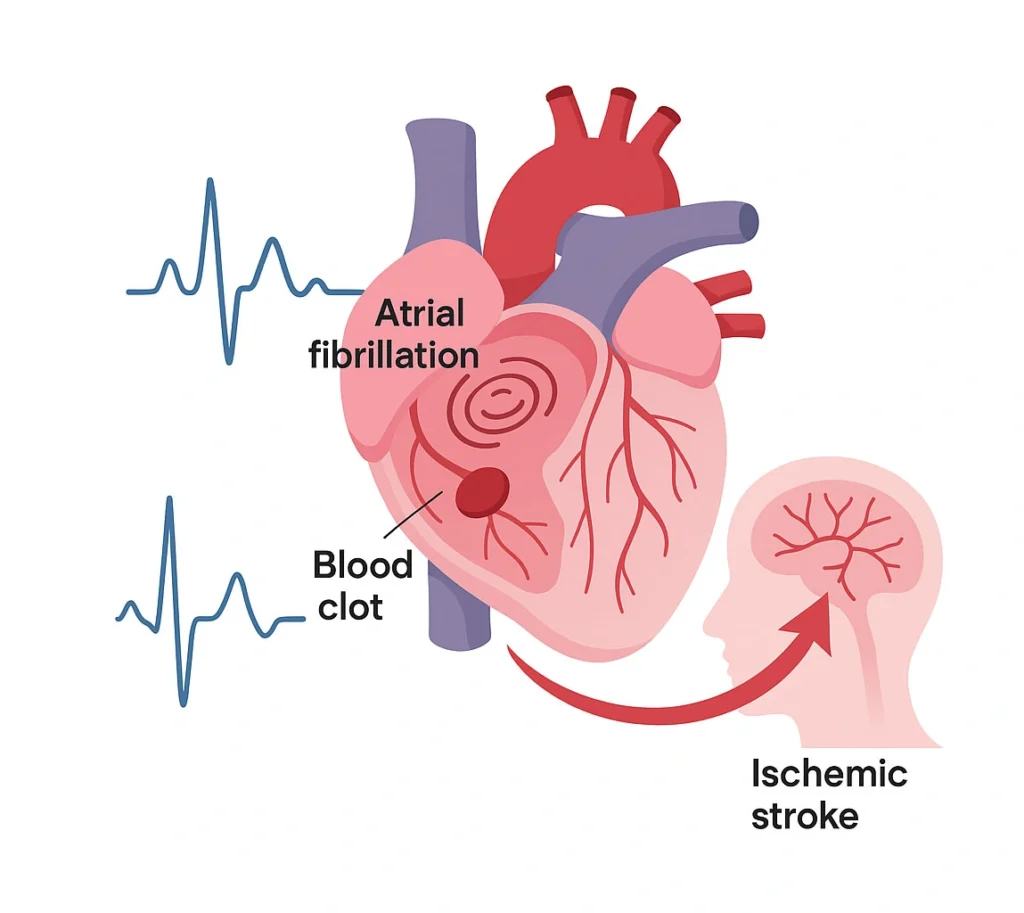Cardio-HART Case-Finding Service for World Thrombosis Day